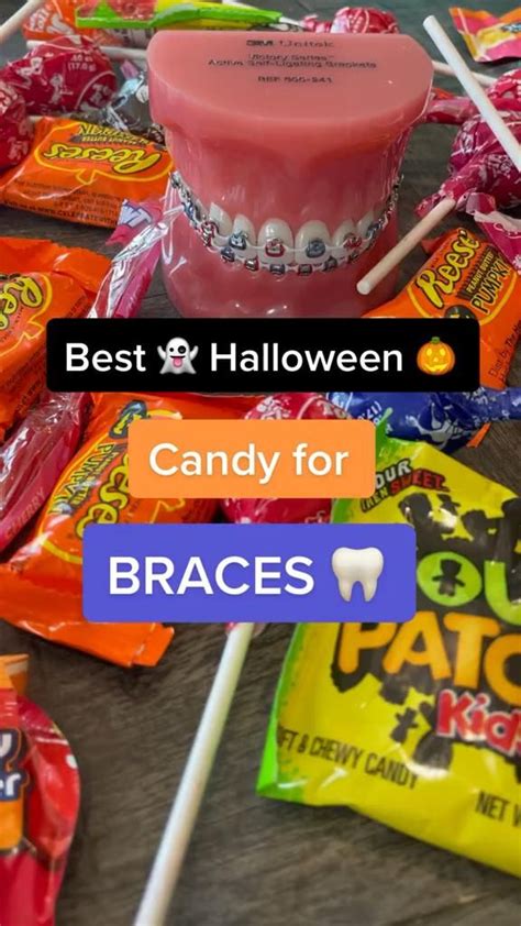 Braces Vs Candy 🍭 Braces Tips Cute Braces Braces