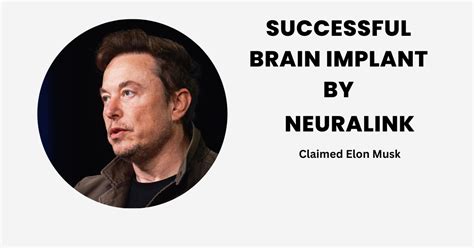 Elon Musk Reveals Successful Human Brain Implant By Neuralink