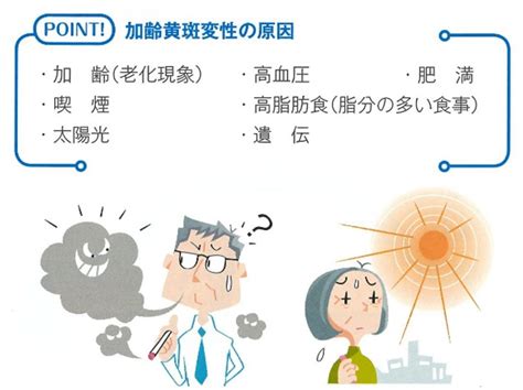 加齢黄斑変性 長久手市下山 藤が丘駅近くの眼科｜きとう眼科クリニック