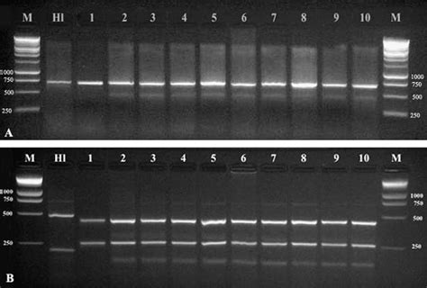 A Pcr Amplification Of Mitochondrial Co1 Genes Of Hypoderma Species