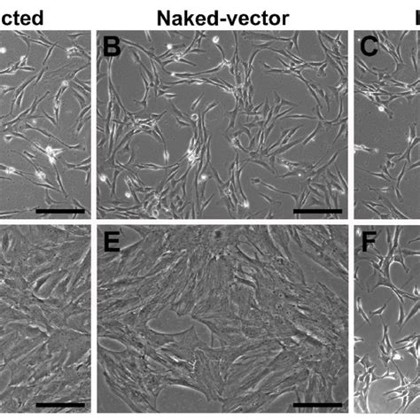 Representative Phase Contrast Microscopy Images Revealing The Phenotype