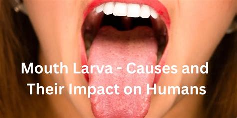 Mouth Larva Understanding Oral Myiasis And Its Treatment