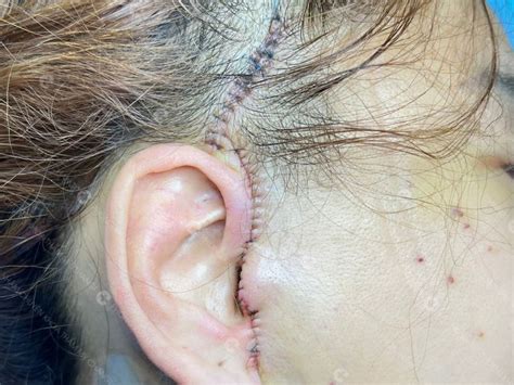 Địa Chỉ Căng Da Mini Plus Uy Tín Tại Thành Phố Hồ Chí Minh Phòng Khám