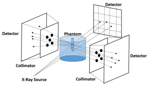 Figure 1 From Joint Optimization Of Collimator And Reconstruction Parameters In X Ray