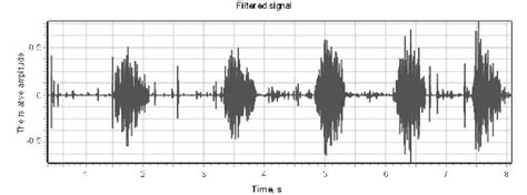 A Typical Image Of A Bronchi Phonogram After Bandpass Filtering In The