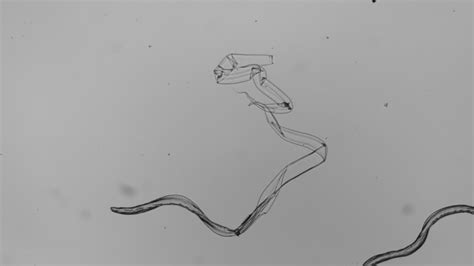 American Murderer Worm Strips To Evade Your Immune System Live Science