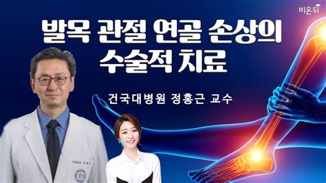 발목을 접질렸는데 1주일 이상 아프다면‘발목 관절 연골 손상을 의심해 보세요 건국대병원 정홍근 교수 And 차종은 Pd