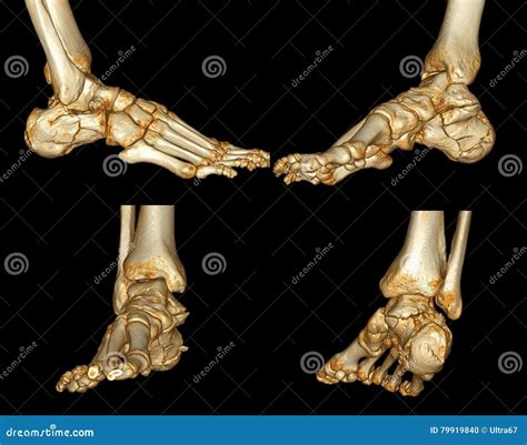 Human Foot Anatomy Navicular Bone Of The Foot Stock Illustration 252496675