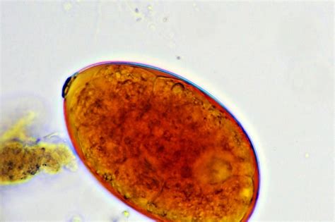 Premium Photo Understanding Preventing And Treating Trichinellosis