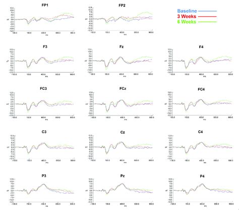 ERP Changes Shown In 14 Channels According To 3 Time Points Download Scientific Diagram