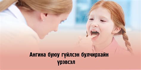 Ээжүүд апп Хоолой өвдсөн үед бүрэн эмчлээрэй Гүйлсэн