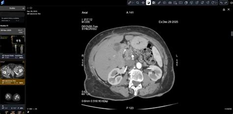 Diagnostic Center Pacs Reporting Software At Best Price In Bengaluru