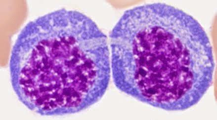 Fichero de Hematología Heber Mayén Proeritroblasto basófilo