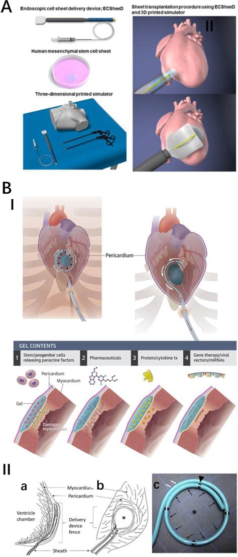 Recent Fabrications And Applications Of Cardiac Patch In Myocardial