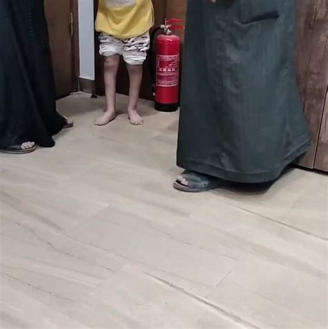 Dr Mohammed Atef On Linkedin A Case Of A Female 6year Old She Was Diagnosed With Neglected