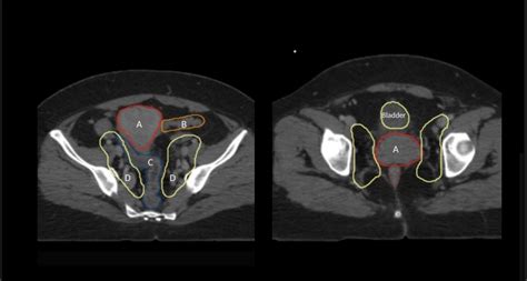 CT Anatomy 9 Diagram Quizlet