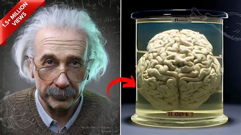 How Albert Einstein S Brain Was Different From Other Human Beings