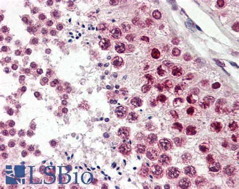 IHC Plus CIRP CIRBP Polyclonal Antibody Goat Anti Human LSBio