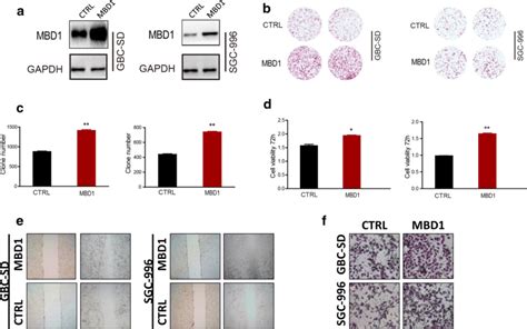 Mbd1 Enhances The Proliferation Invasion And Migration Capabilities Of