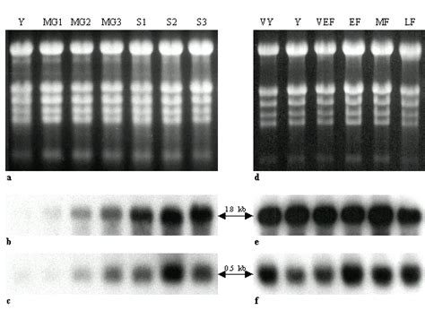 Fractionated Rna Approximately 10 μg In Each Track On Denaturing
