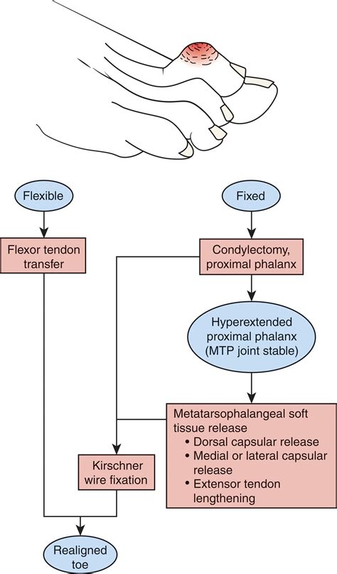 Lesser Toe Deformities Clinical Tree