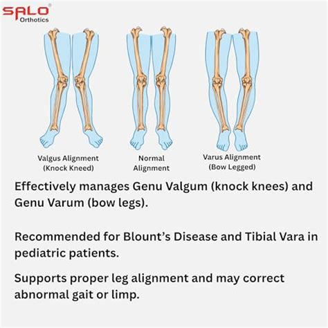 Salo Orthotics Knock Knee And Bow Legs Brace Genu Valgum Genu Varum