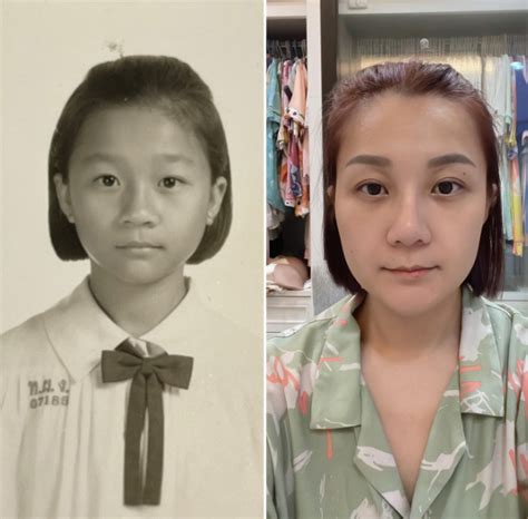 เอ็ม บุษราคัม ศัลยกรรมอะไรบ้าง ตั้งแต่อดีตถึงปัจจุบัน