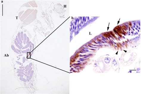 Jev Infection Of Posterior Midgut Epithelial Cells In The C Pipiens