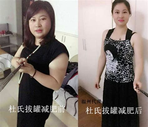 拔罐减肥中医秘方美容塑身杜氏大唐品牌加盟连锁官网 临沂大唐世家美容服务有限公司