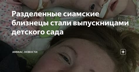 Разделенные сиамские близнецы стали выпускницами детского сада Ammiac