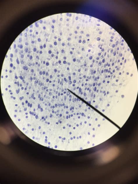 Solved Allium Onion Root Tip At 400X Total Magnification Chegg
