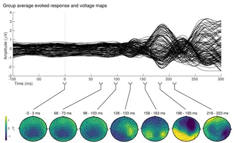 group sensor space results grand average evoked response top and