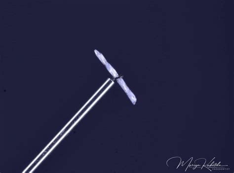 The Broken File To Retrieve Or To Leave Style Italiano Endodontics