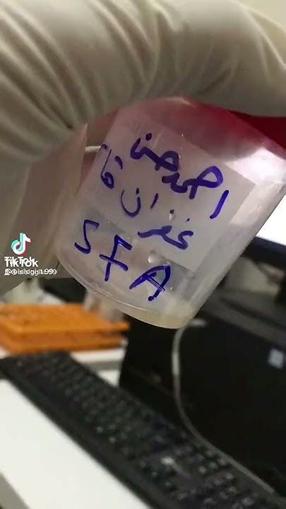 شكل السائل المنوى تحت الميكروسكوب Youtube