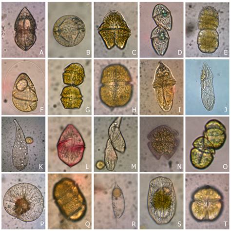 Light Microphotographs Of Unarmored Dinoflagellates Detected During The