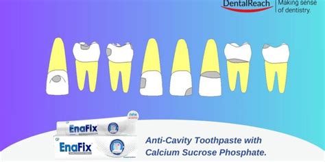 Gv Black Classification Understanding The Foundations Of Cavity