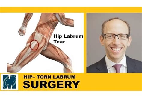 Hip Pain Torn Labrum Hip YouTube