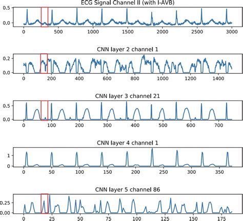Features Extracted By Different Cnn Layers From Ecg Signals Download