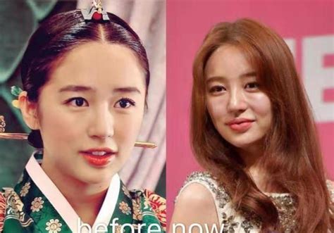 尹恩惠暴瘦复出，粉丝们并不买账：女神变丑了 每日头条
