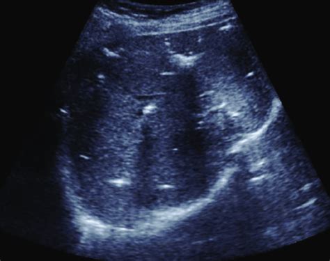 Biliary Tree Pathology Flashcards Quizlet