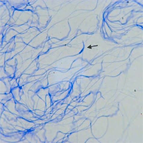 Gram Staining Of Sperm Cells To Reveal Chromatin Condensation Status Download Scientific