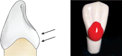 Cingulum Tooth