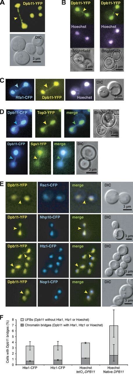 Dpb11 Associates With Chromatin Free Anaphase Bridges In Mitotic Cells