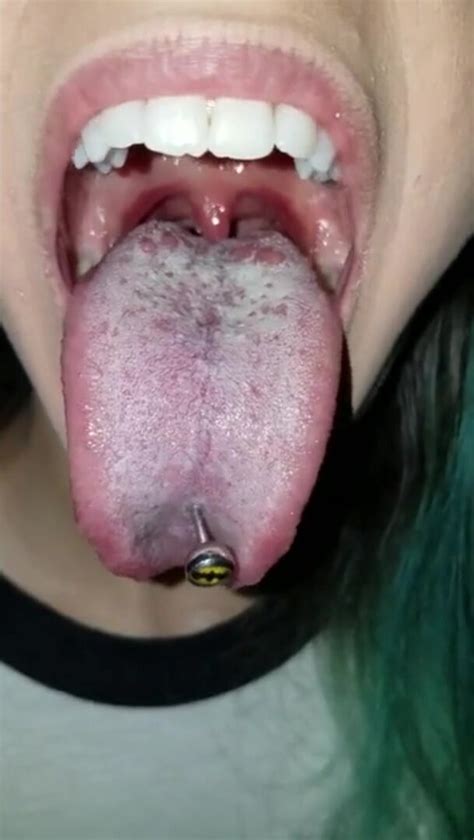 Fat And Long White Tongue