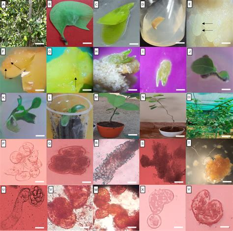 Somatic Embryogenesis And Plantlet Regeneration From An Immature