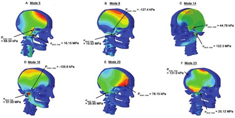Multiple Biomechanical Responses Contour Plots Of The Head Neck Model