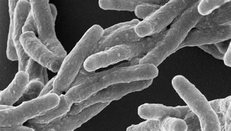 Tuberkulose Spreder Sig I Sydgrønland