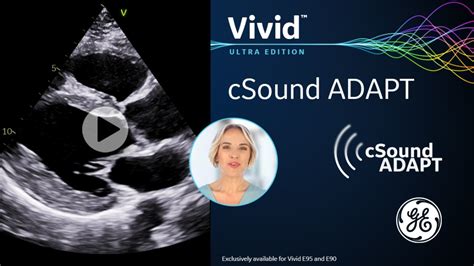 Ge Healthcare On Linkedin Vivid Cardiovascular Ultrasound Systems