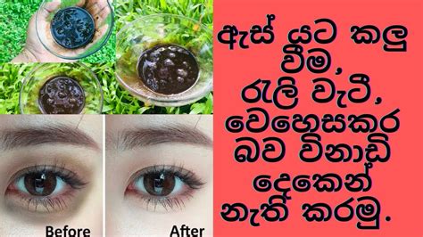 ඇස් යට කලු වීම රැලි වැටීම වෙහෙසකර බව විනාඩි දෙකෙන් නැති කරමු Youtube