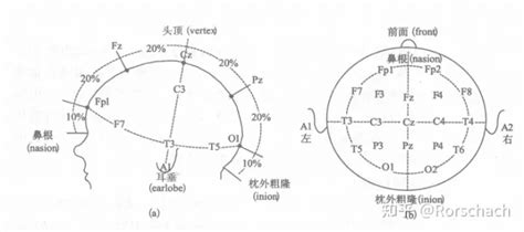 脑电信号基础gibbs分类 Csdn博客